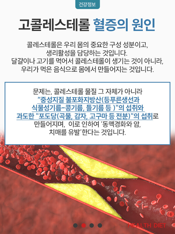 고지혈증 고콜레스테롤 그리고 지방간
